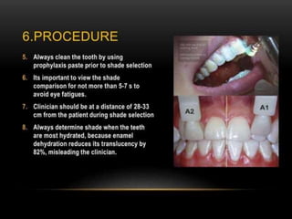 Shade Selection.pptx
