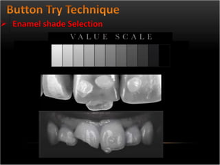 Shade Selection.pptx