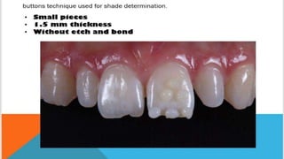 shade selection 1 (1).pptx