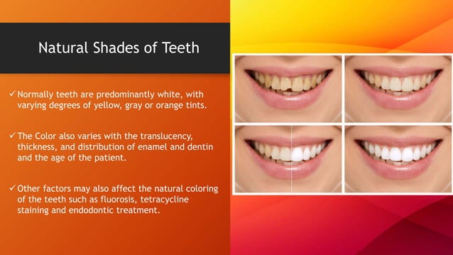 Shade selection in composite restorations | PPTX