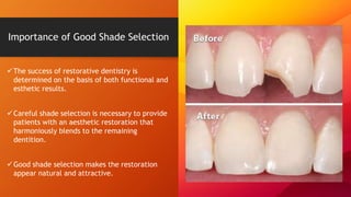 Shade selection in composite restorations | PPTX