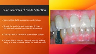 Shade selection in composite restorations | PPTX