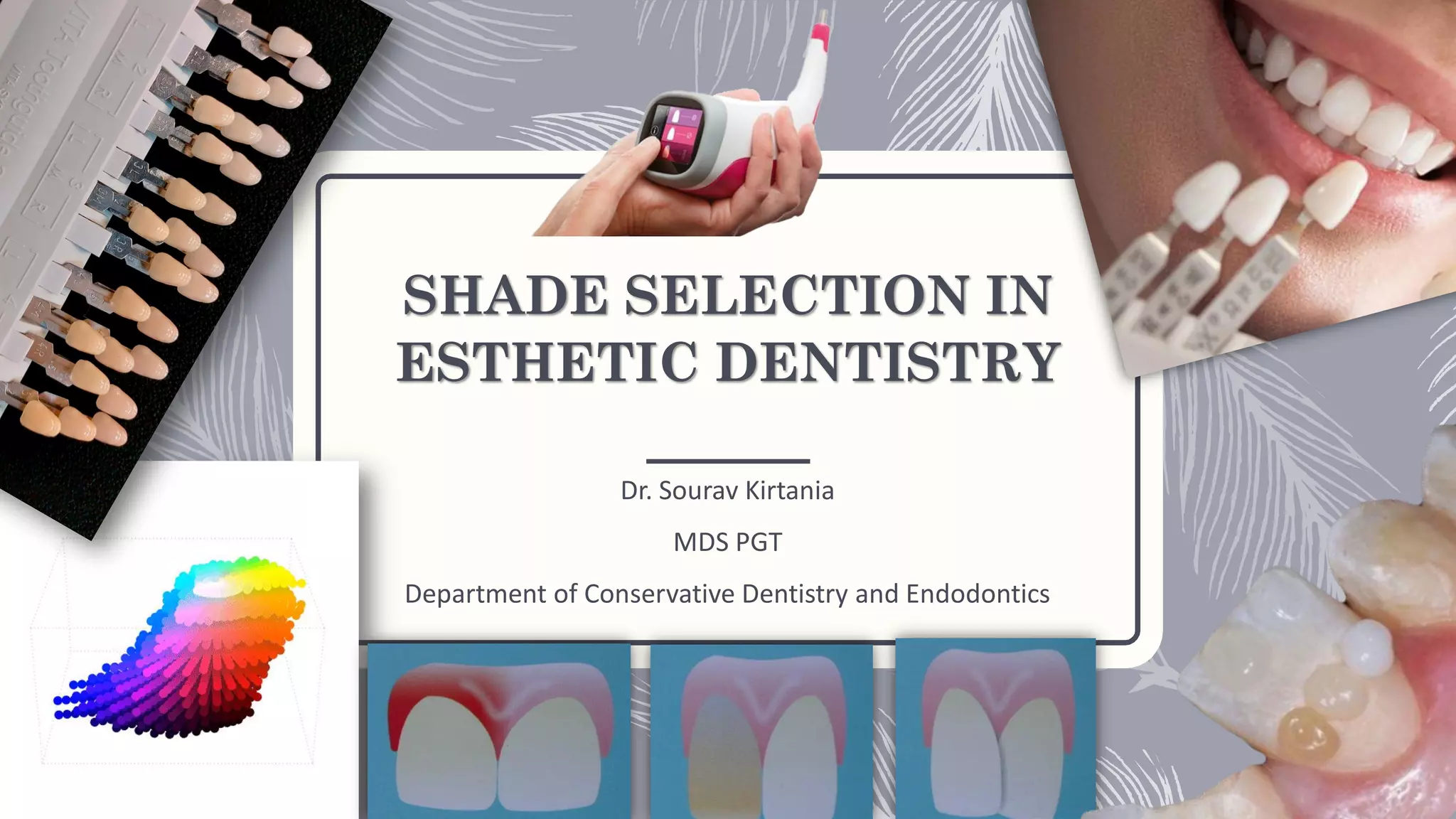 SHADE SELECTION IN ESTHETIC DENTISTRY.pdf