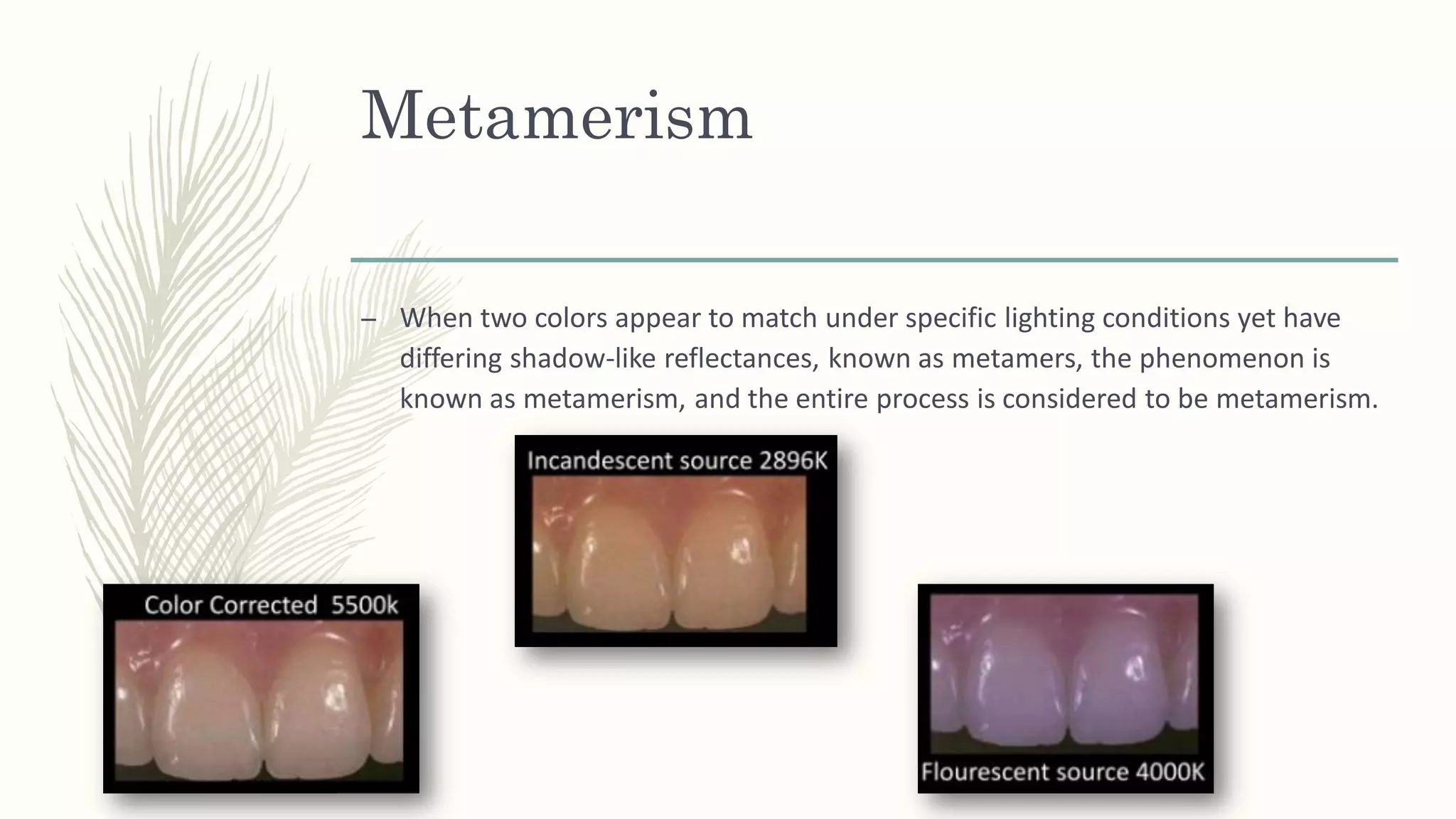 SHADE SELECTION IN ESTHETIC DENTISTRY.pdf
