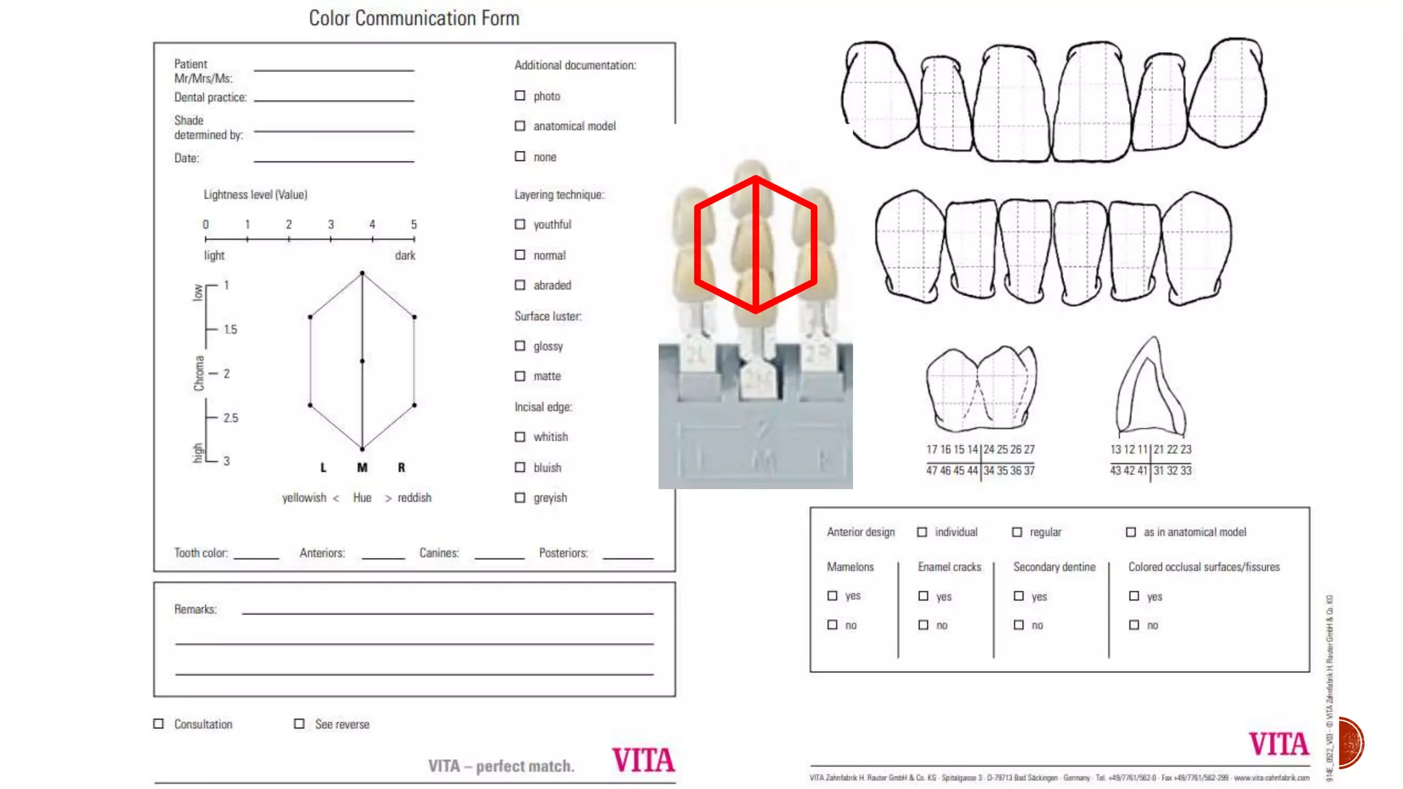 shade selection seminar.pptx