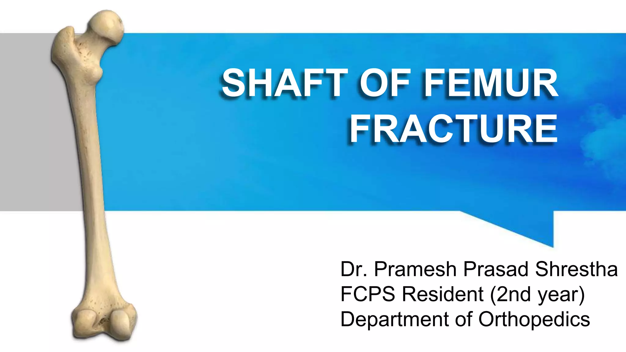 Shaft of femur fracture | PPTX