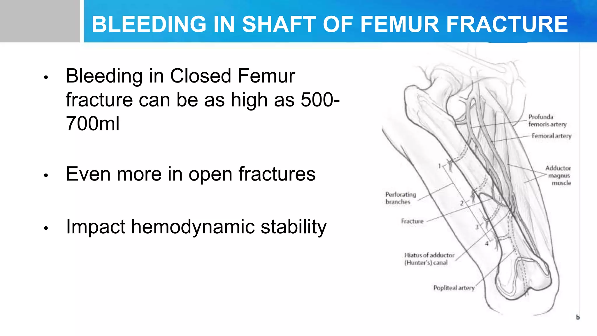 Shaft of femur fracture | PPTX
