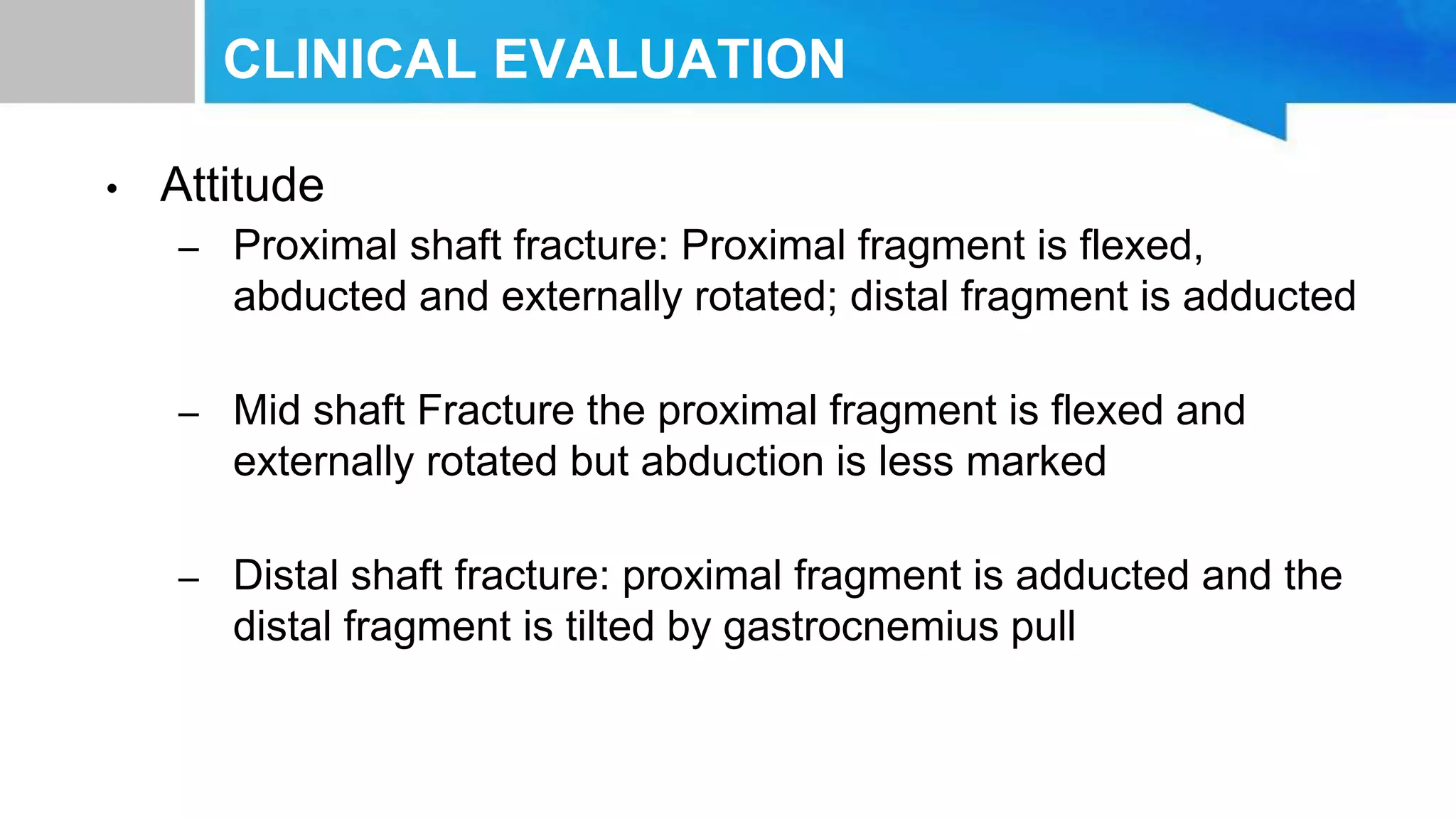 Shaft of femur fracture | PPTX