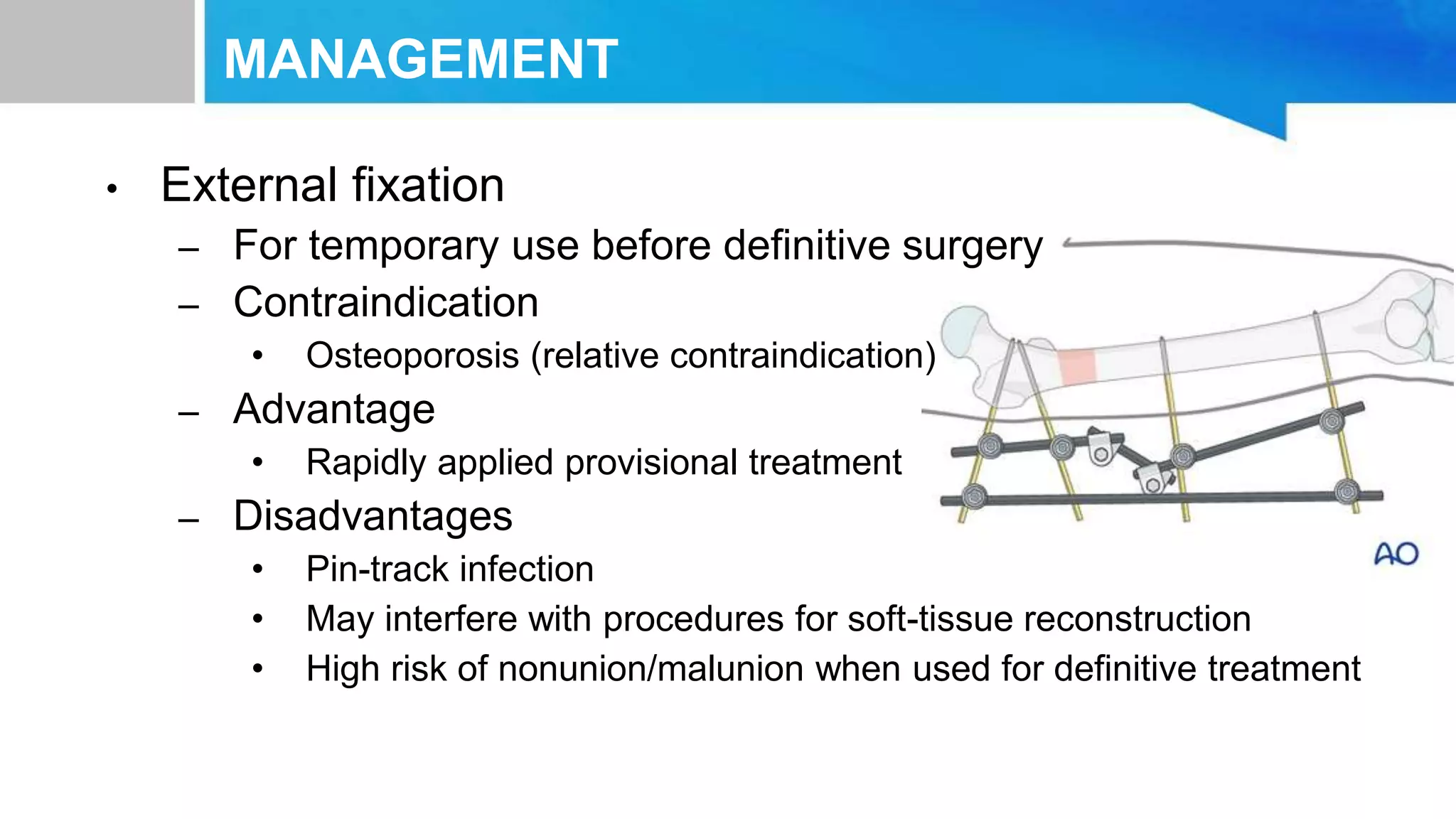 Shaft of femur fracture | PPTX