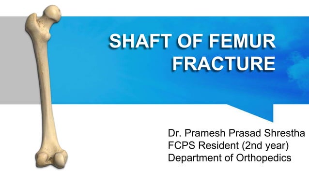 Shaft of femur fracture | PPTX