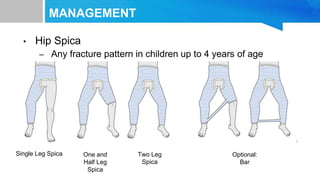 Shaft of femur fracture | PPTX
