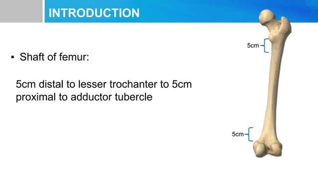 Shaft of femur fracture | PPTX