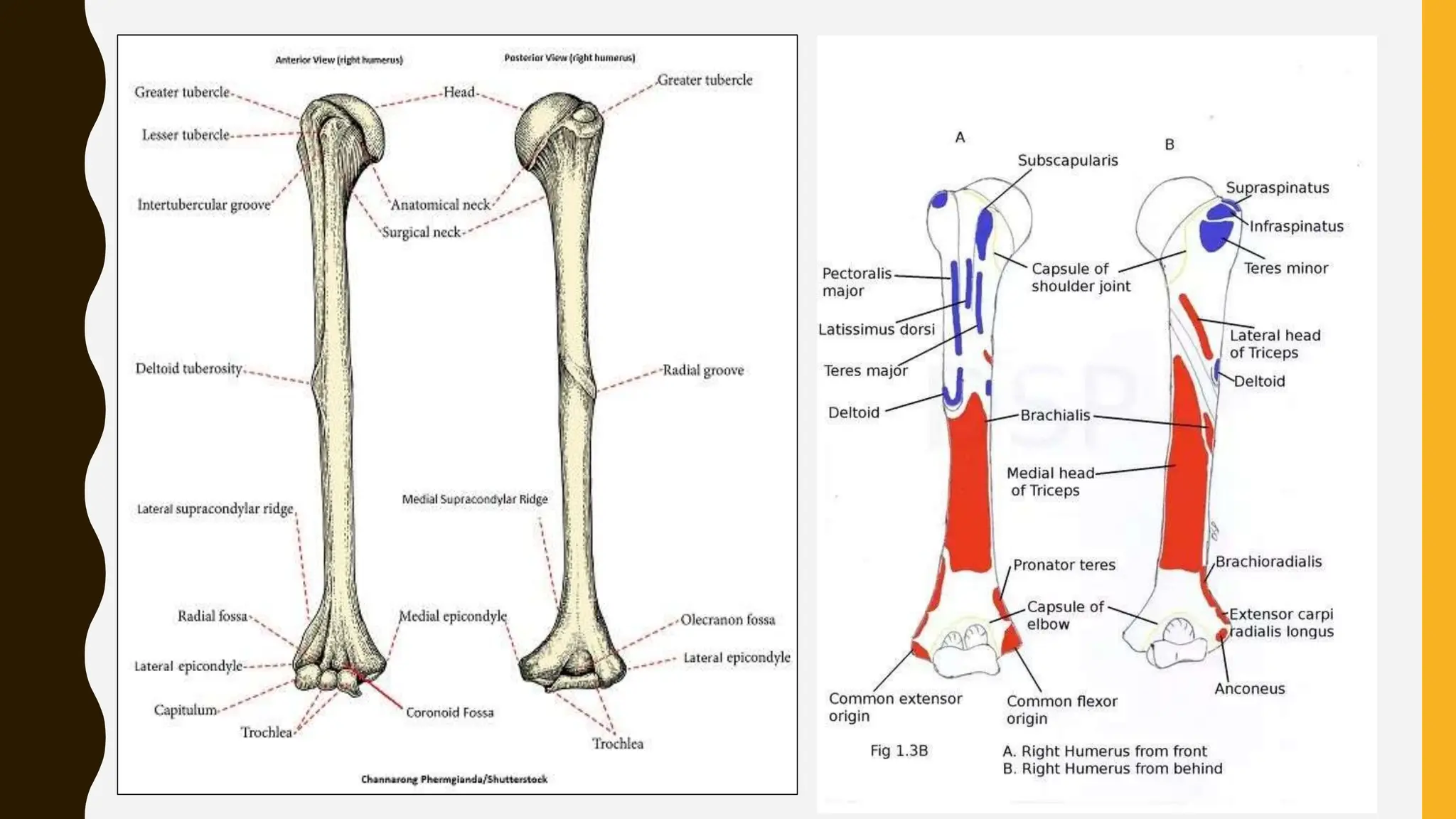 shaft of humerus fracture orthopedics ppt | PPTX