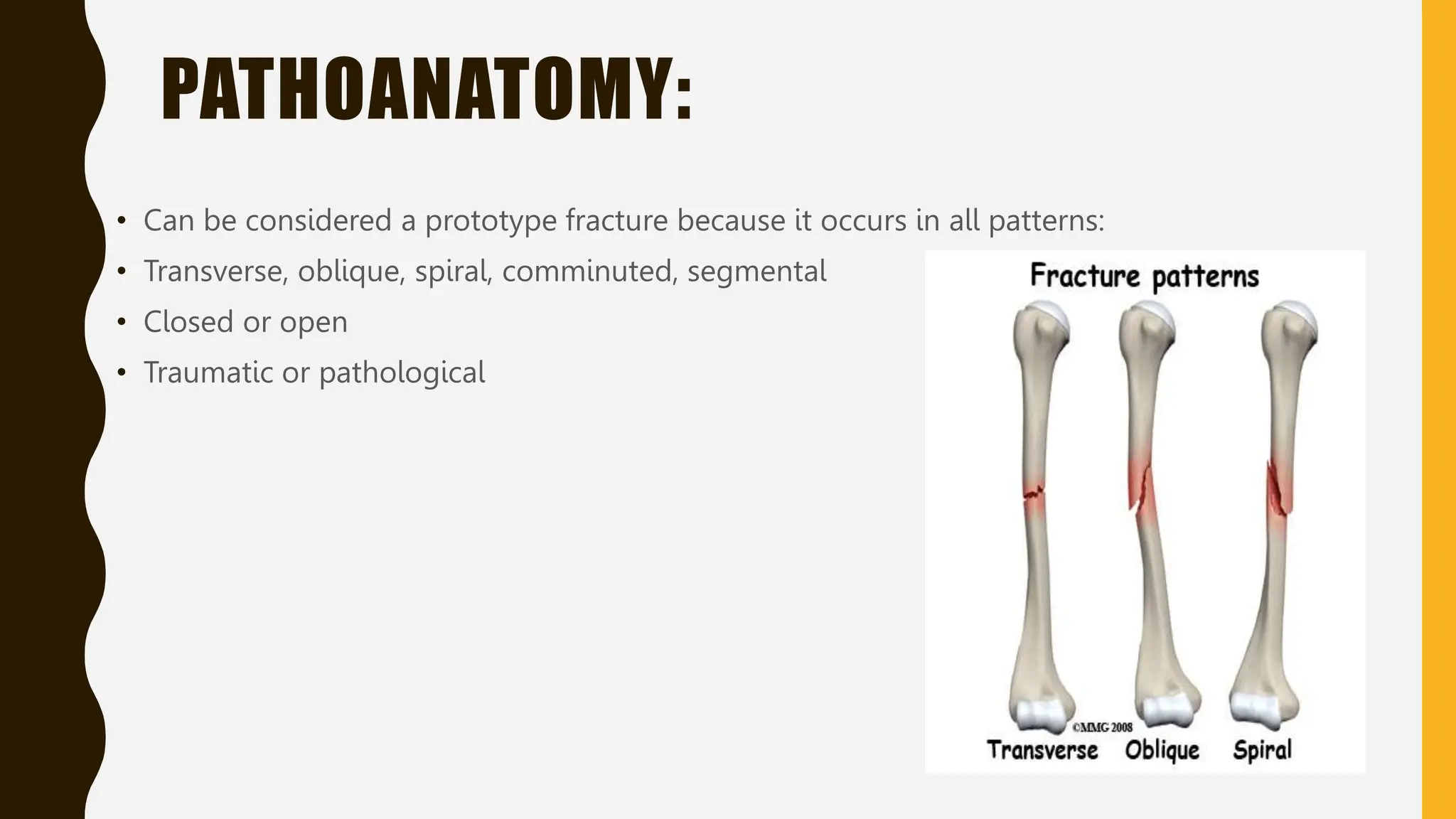 shaft of humerus fracture orthopedics ppt | PPTX