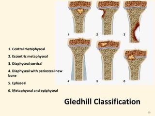 Shah alam sir om (2) | PPT