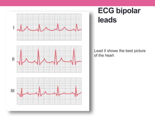 ECG | PPTX