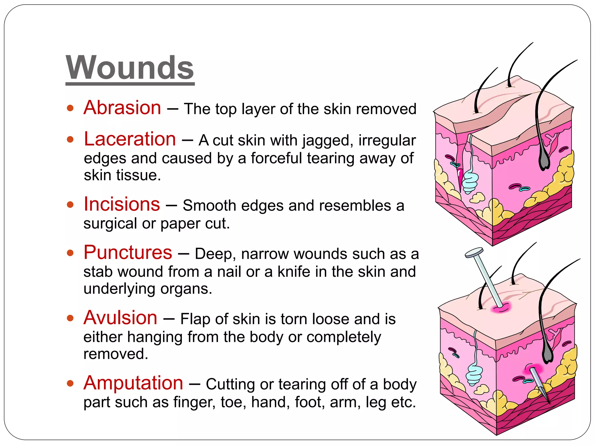 First Aid ppt | PPTX