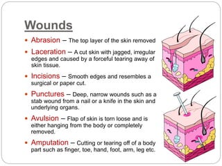 First Aid ppt | PPTX | First Aid | Injuries