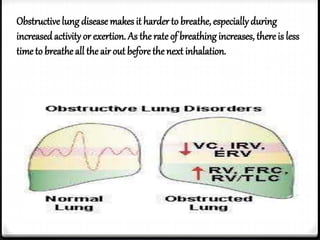obstructive and restrictive lungs failure | PPT