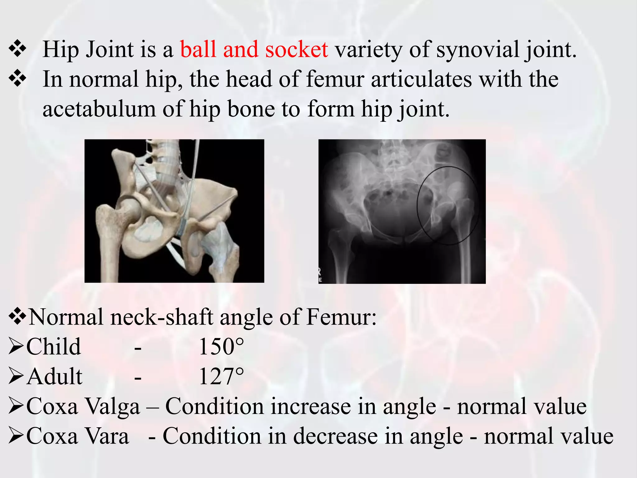 Dislocation of hip joint | PPTX