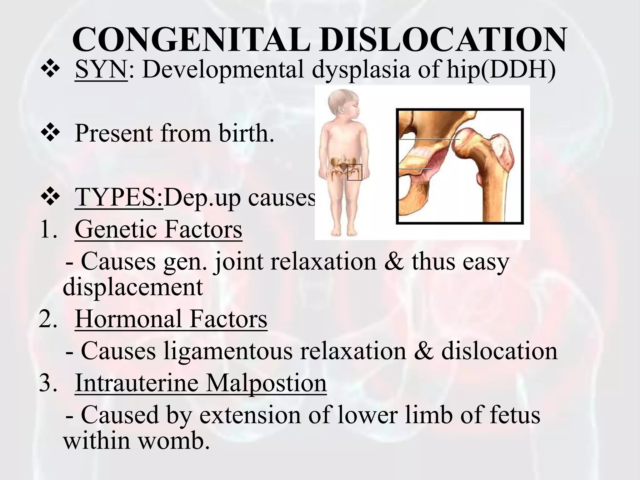 Dislocation of hip joint | PPTX