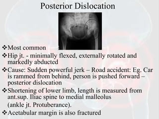 Dislocation of hip joint | PPTX