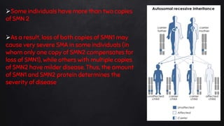 spinal muscular atropy- ayurveda | PPTX