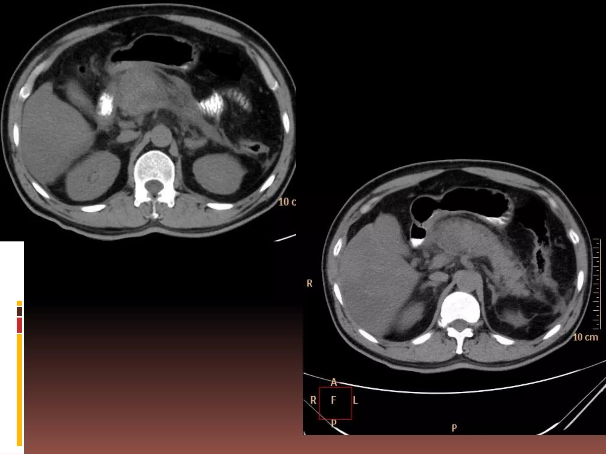 interesting ct scan cases | PPTX