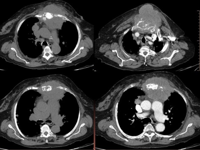 interesting ct scan cases