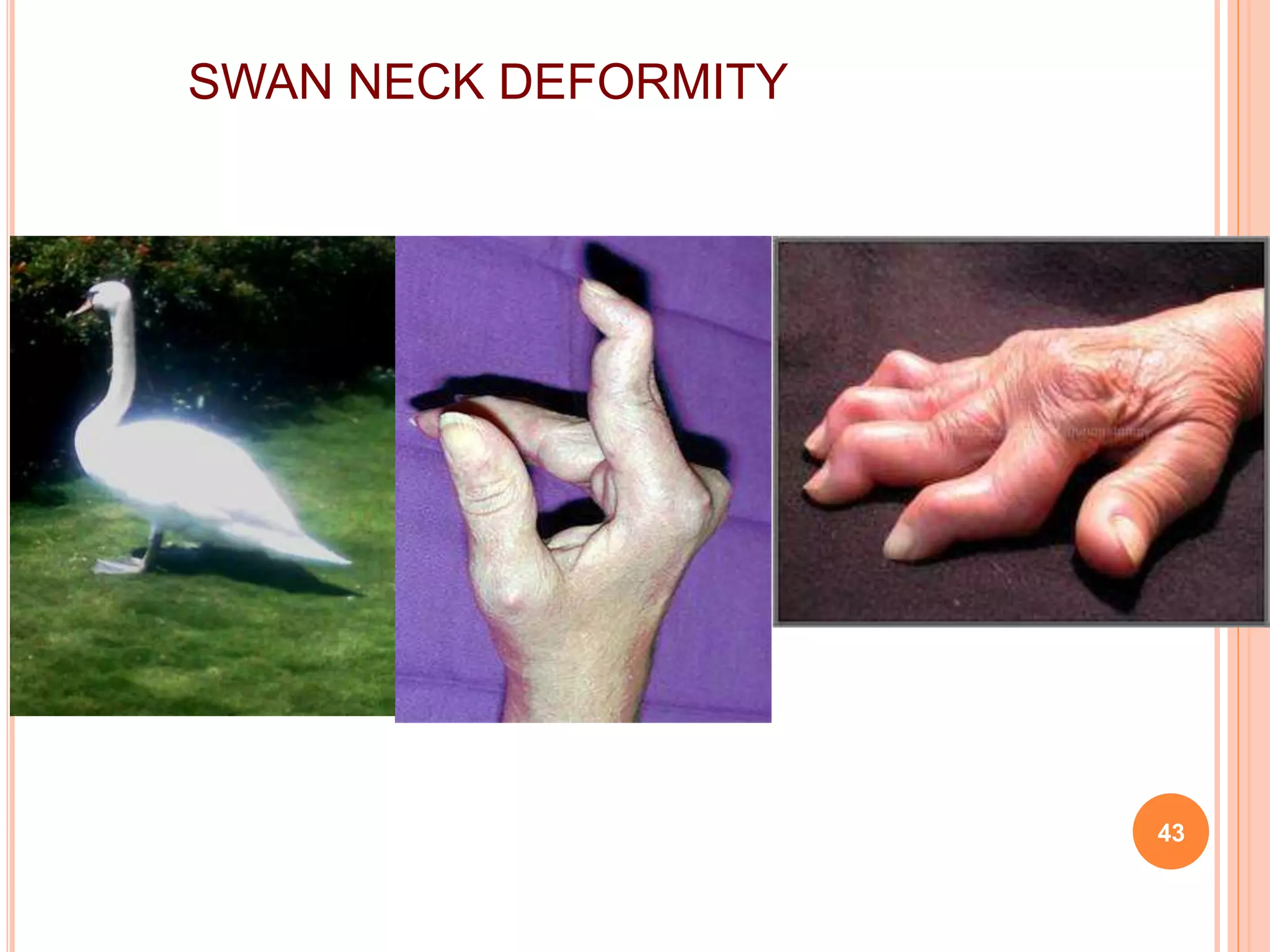 Case Presentation- Amavata | PPTX