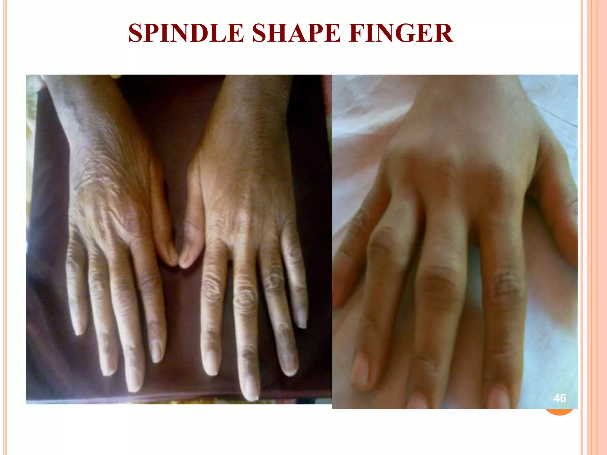 Case Presentation- Amavata | PPTX