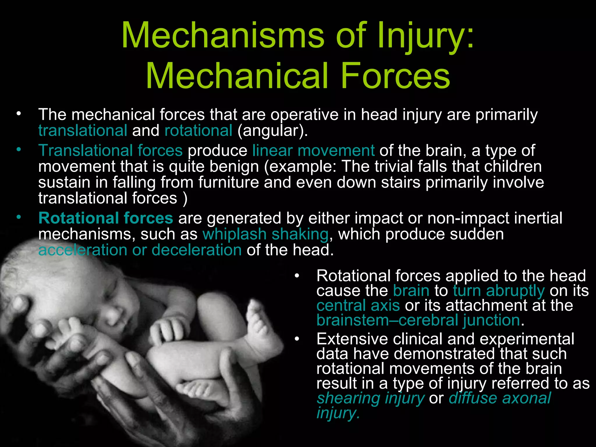 Shaken baby syndrome | PPT