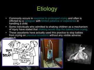 Shaken baby syndrome | PPT
