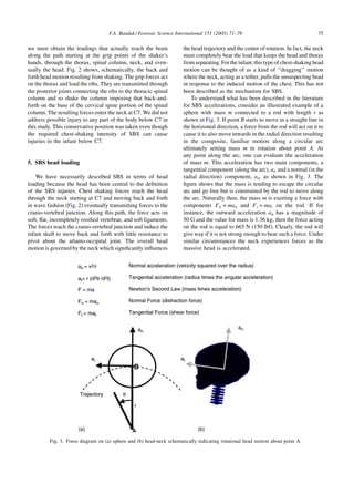 Shaken baby syndrome a biomechanics analysis of injury mechanisms | PDF
