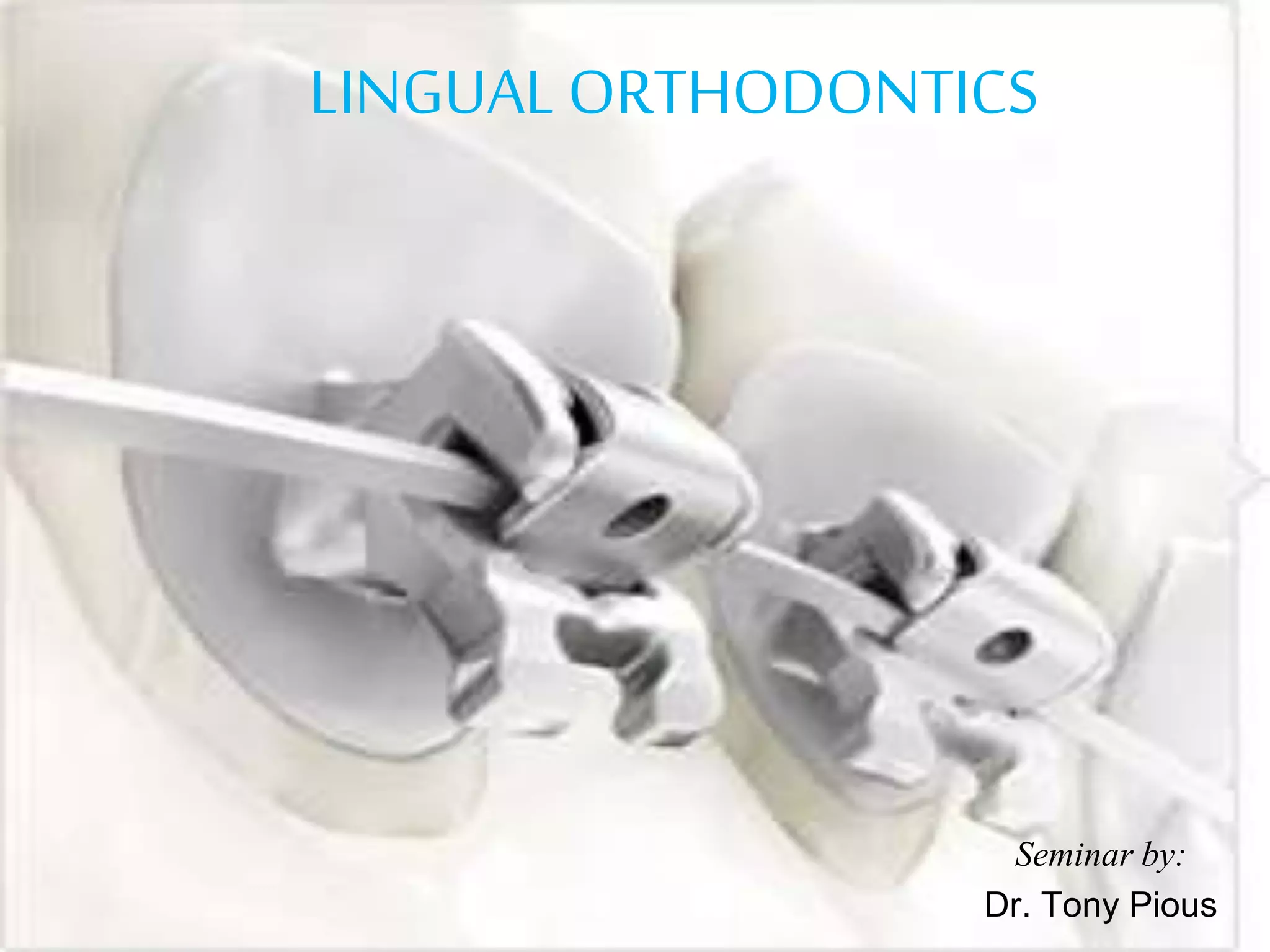 Lingual orthodontics | PPTX