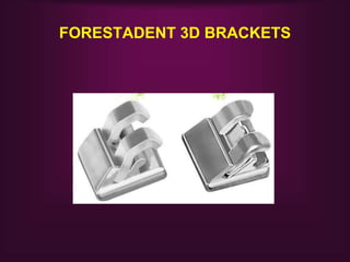 Lingual orthodontics | PPTX