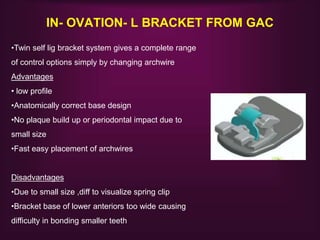 Lingual orthodontics | PPTX