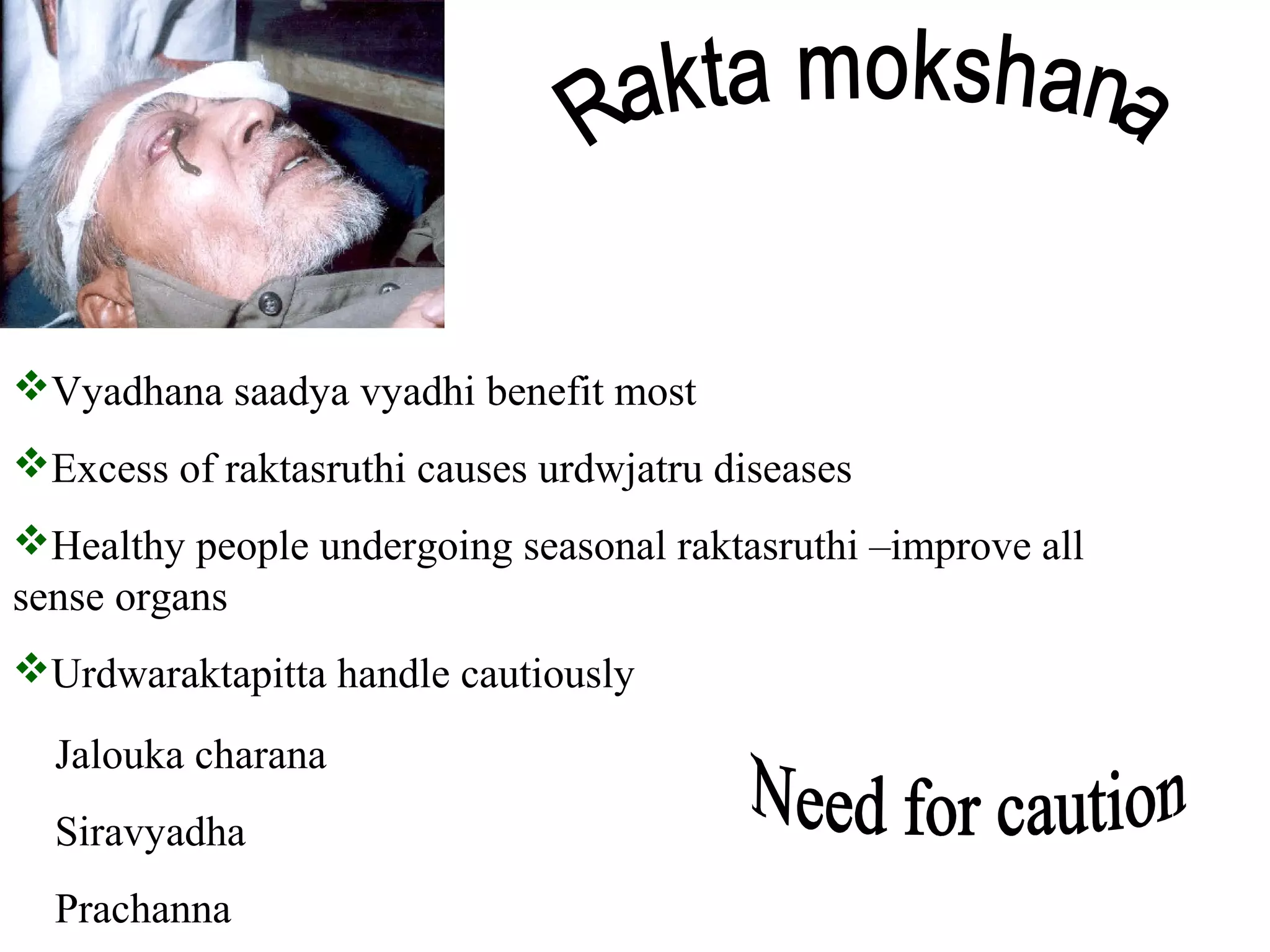 Shalakya panchakarma | PPT