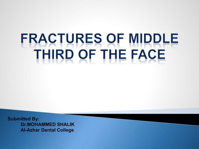 Fractures of middle third of face | PPTX | Death, Injury, or Military ...