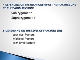 Fractures of middle third of face | PPTX