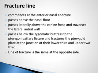 Fractures of middle third of face | PPTX