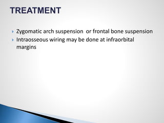 Fractures of middle third of face | PPTX
