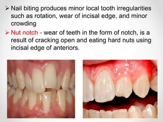 Abnormal Pressure Habits - Orthodontics | PPTX