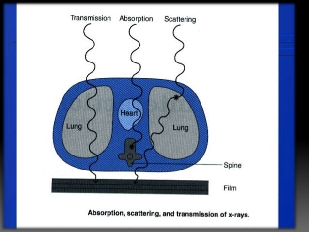 interaction of x ray with matter