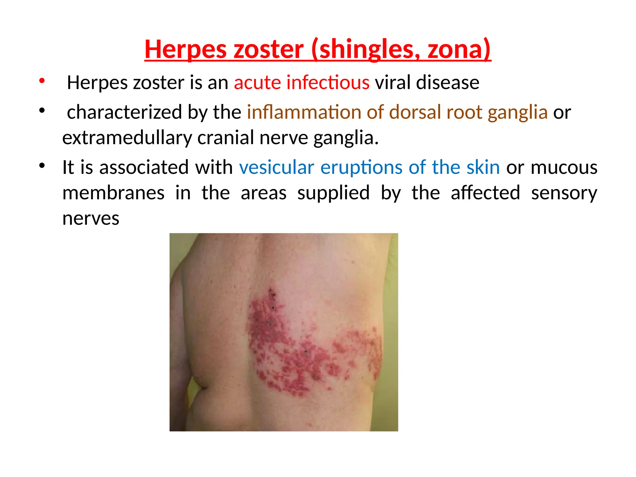 oral manifestation of systemic diseases.pptx