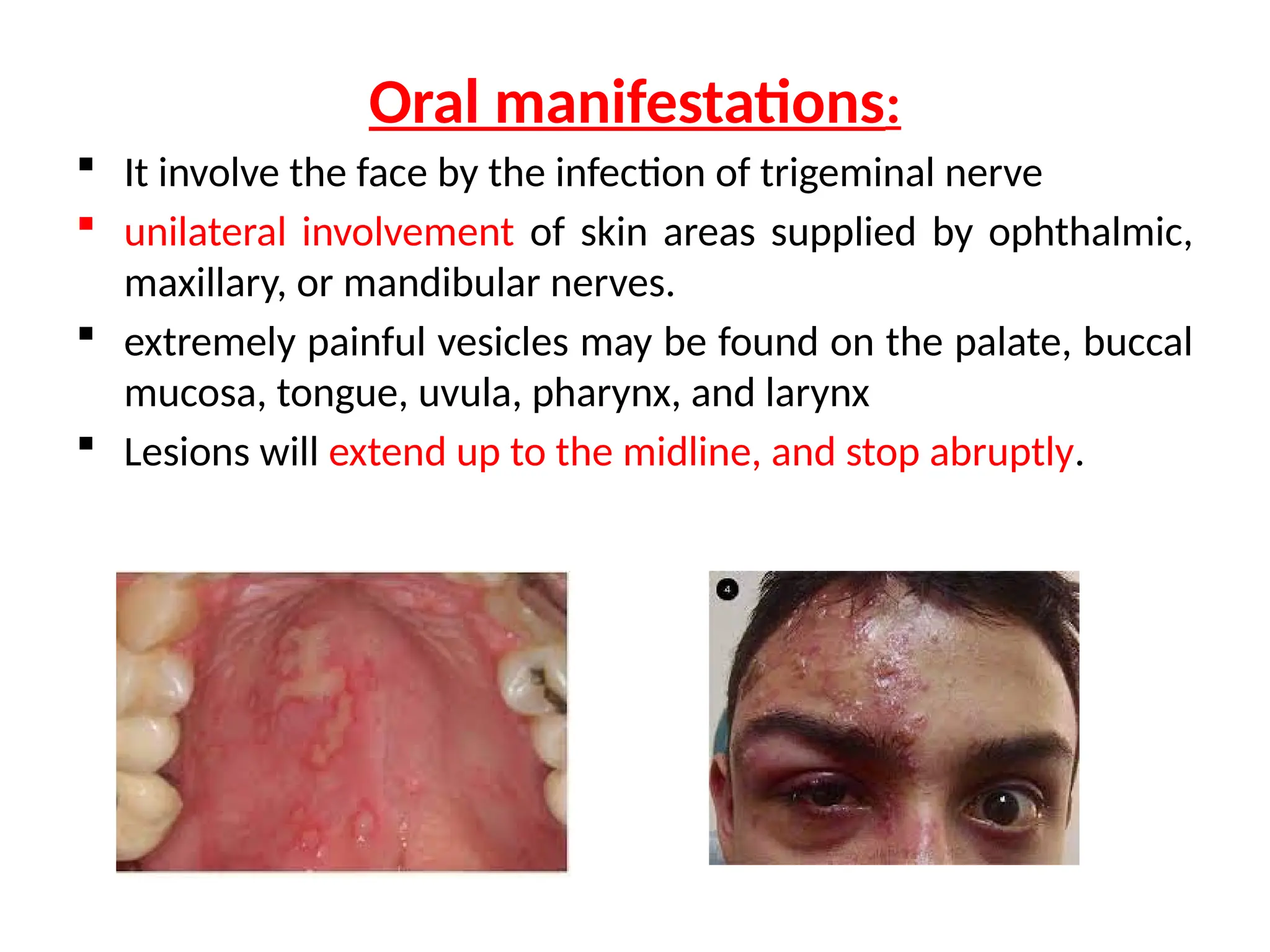 oral manifestation of systemic diseases.pptx