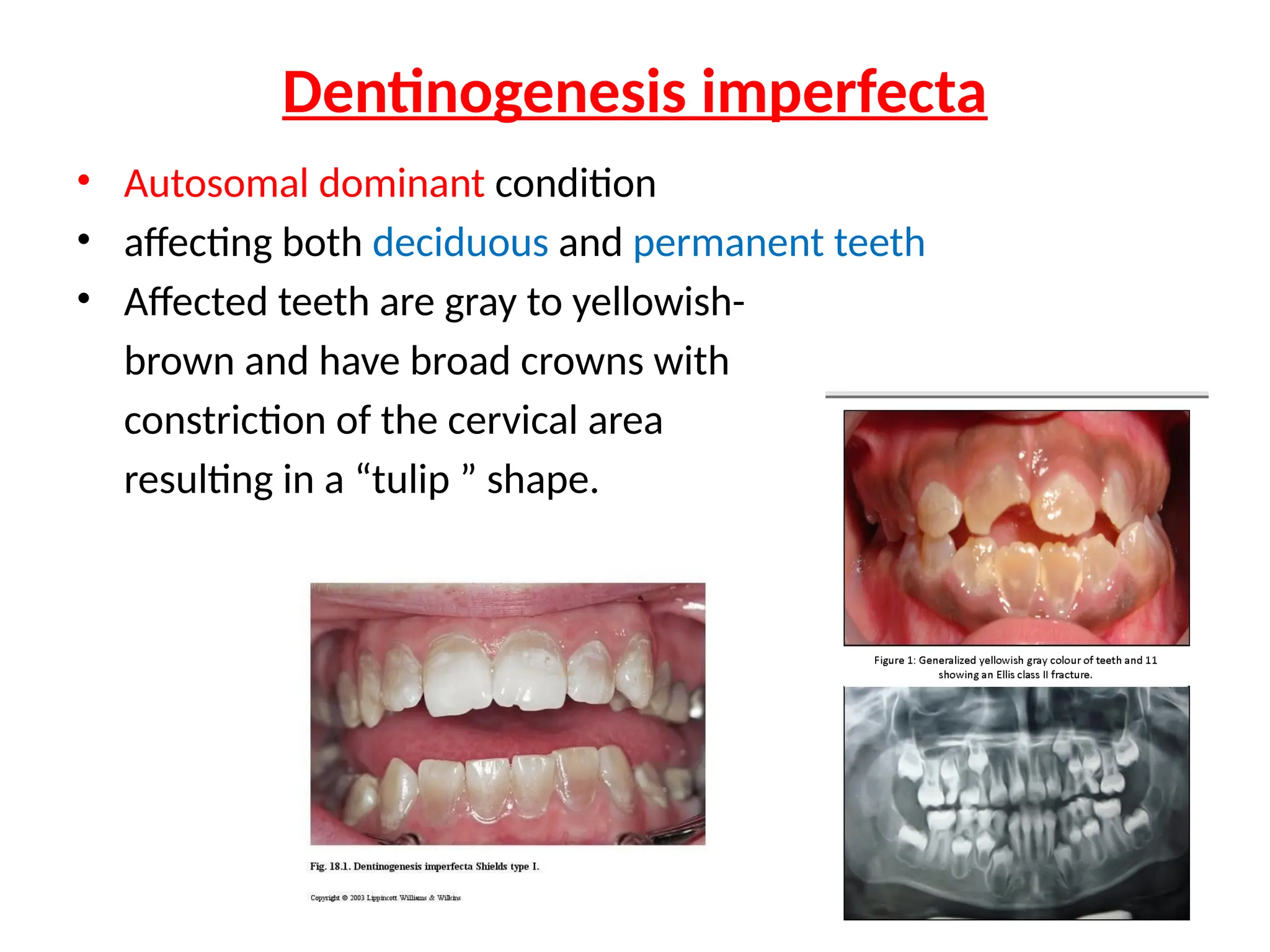 oral manifestation of systemic diseases.pptx