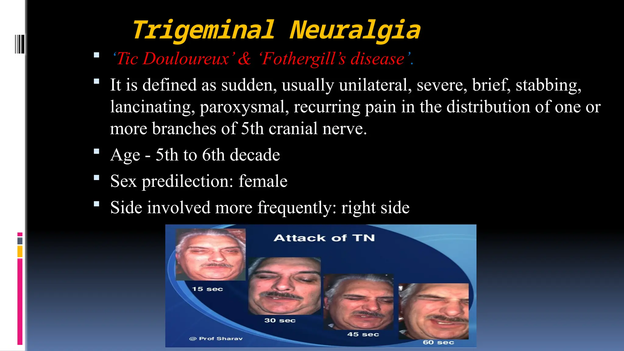 trigeminal nerve and their disease222ptx | PPTX