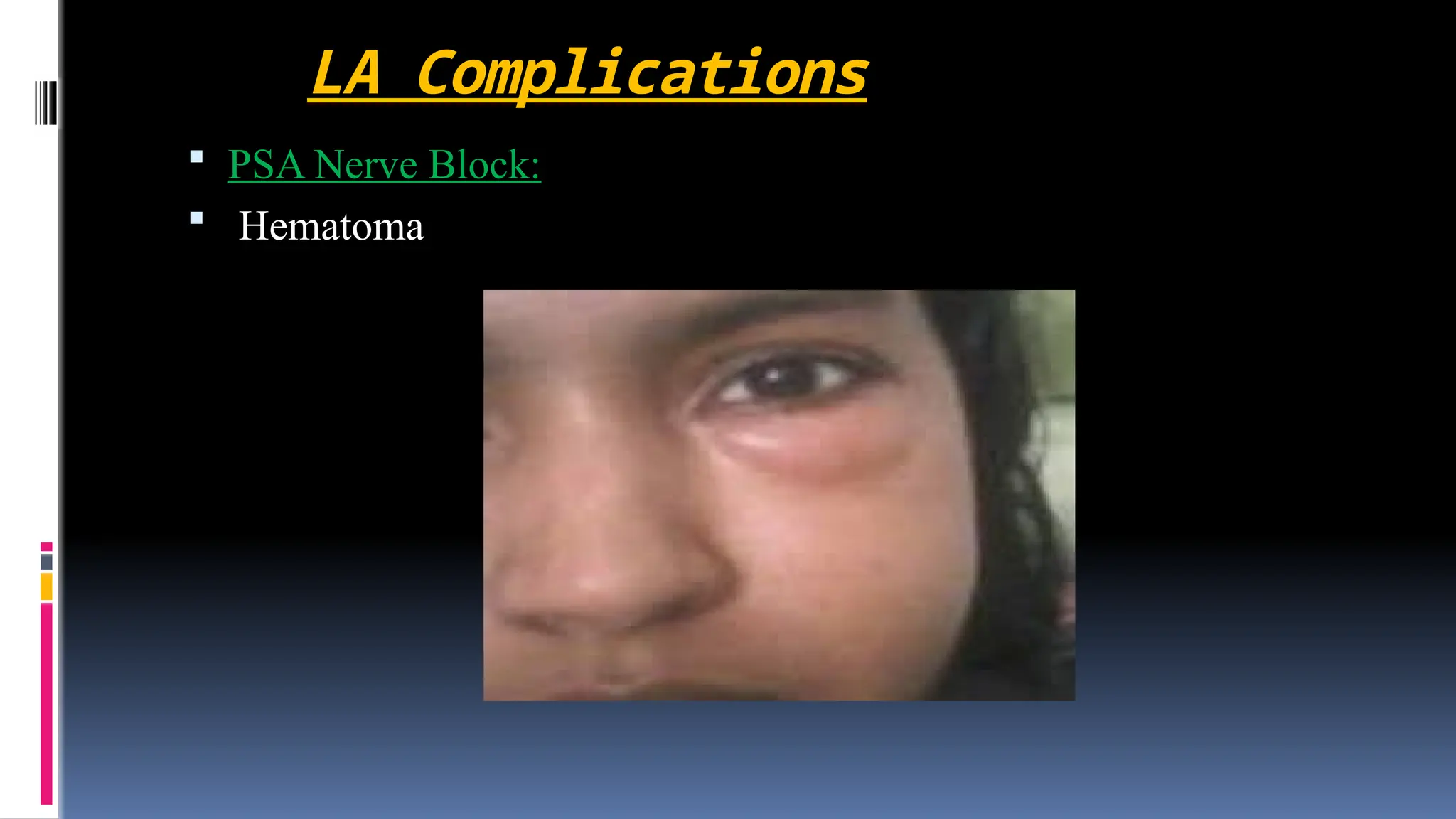 trigeminal nerve and their disease222ptx | PPTX