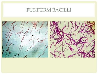 Fusiform Bacilli
